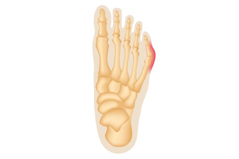 Quintus Varus - Dr Jérémie Knafo